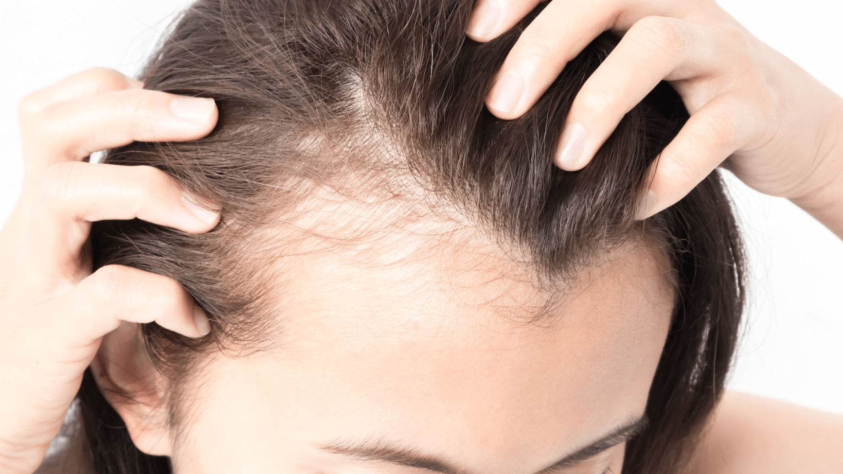 TED™ Hair Restoration: A Solution for Thinning Hair